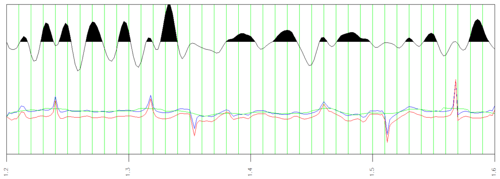 Complex Trace Attribute Overview - Geophysical Insights